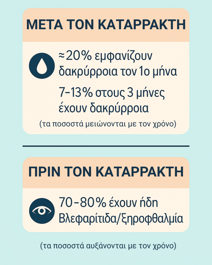 Μετά τον Καταρράκτη – Γιατί Δακρύζουν τα Μάτια & Ο Ρόλος της Υγιεινής ...