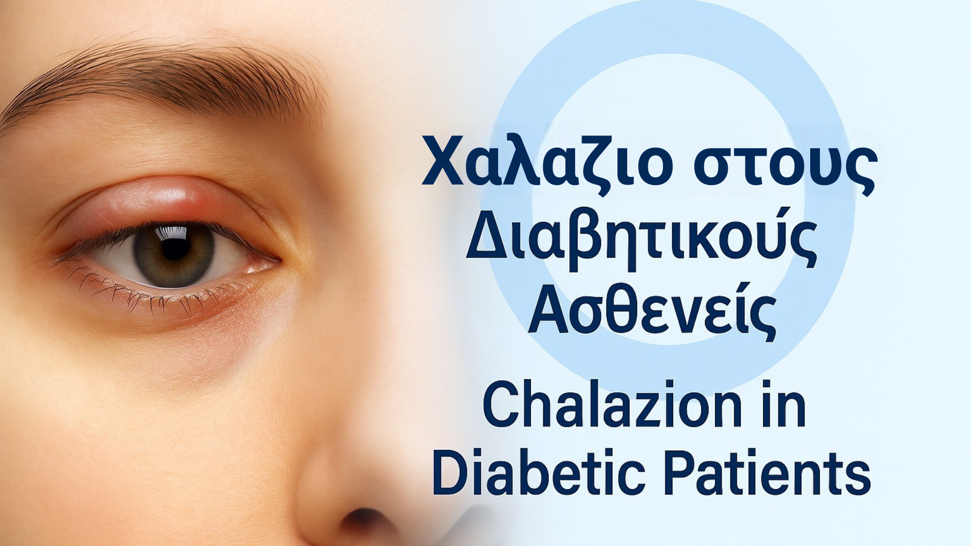 Χαλάζιο στους Διαβητικούς: Αίτια, Συμπτώματα & Θεραπεία | 2025 ...
